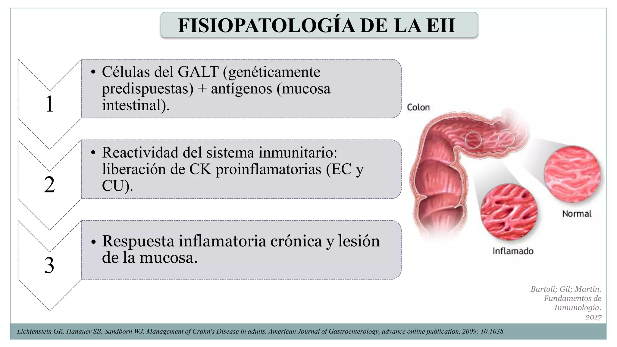 ENFERMEDAD INFLAMATORIA INTESTINAL (EII) ENFERMEDAD DE CROHN (EC ...
