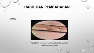 Ppt ektoparasit.pptx