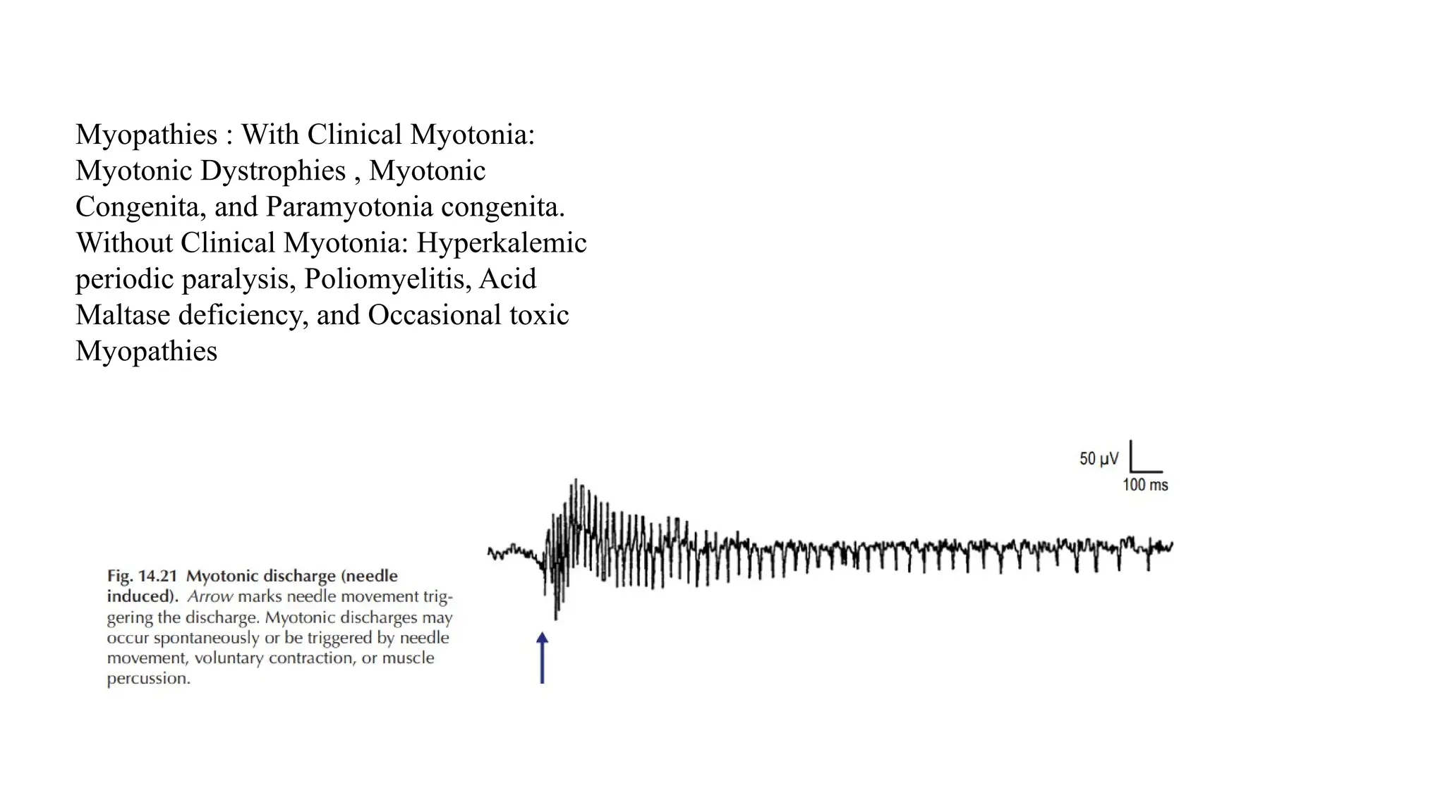 PPT ELECTROMYOGRAPHY BASICS INTERPRETATION AND WAVEFORM ANALYSIS.pptx