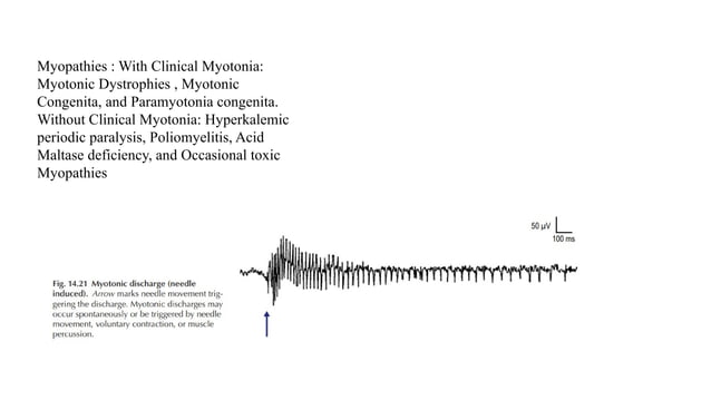 PPT ELECTROMYOGRAPHY BASICS INTERPRETATION AND WAVEFORM ANALYSIS.pptx