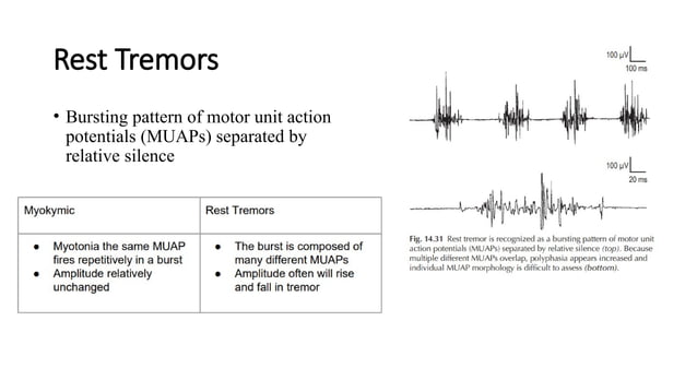 PPT ELECTROMYOGRAPHY BASICS INTERPRETATION AND WAVEFORM ANALYSIS.pptx ...