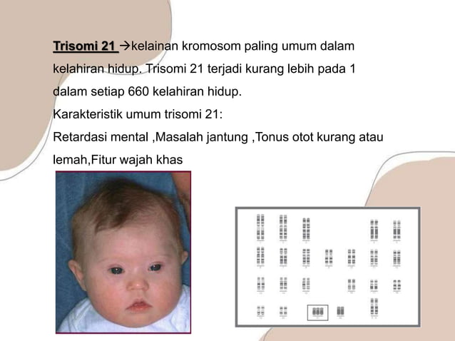 KELAINAN PADA EMBRIO | PPTX