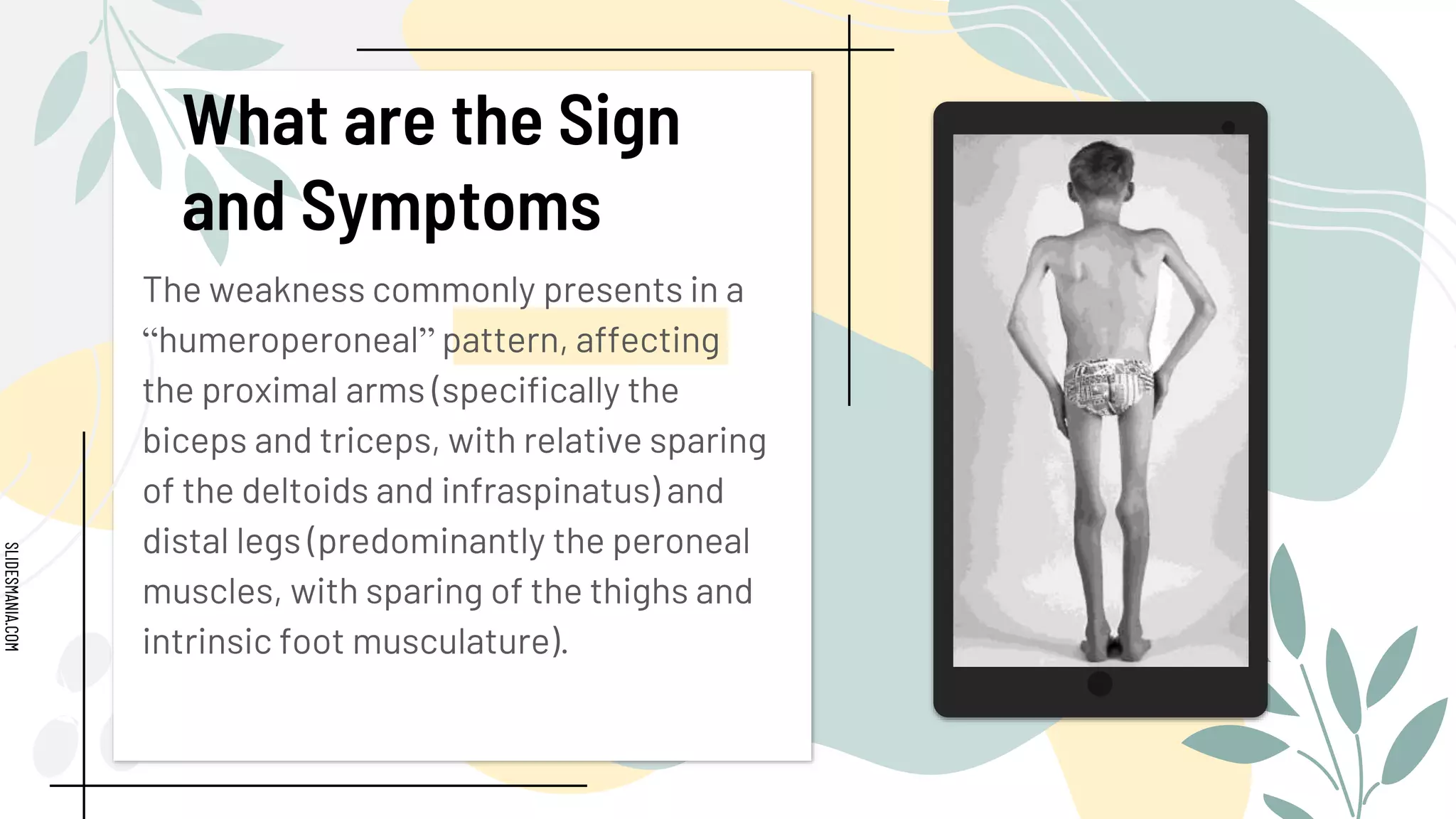 PPT Emery-Dreifuss Muscular Dystrophy.pptx