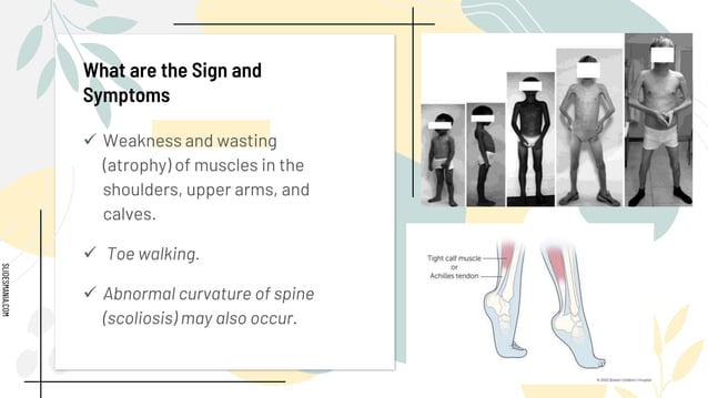 PPT Emery-Dreifuss Muscular Dystrophy.pptx