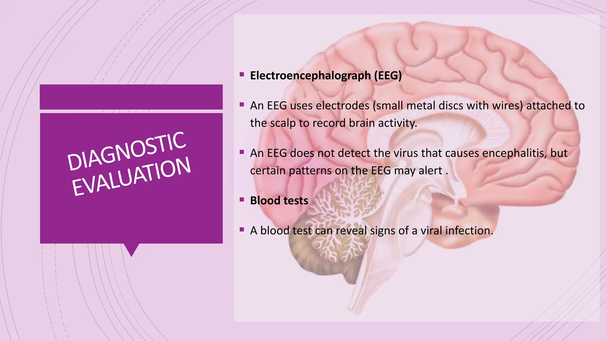 INFECTION OF THE BRAIN -ENCEPHALITIS ( PPT) | PPTX