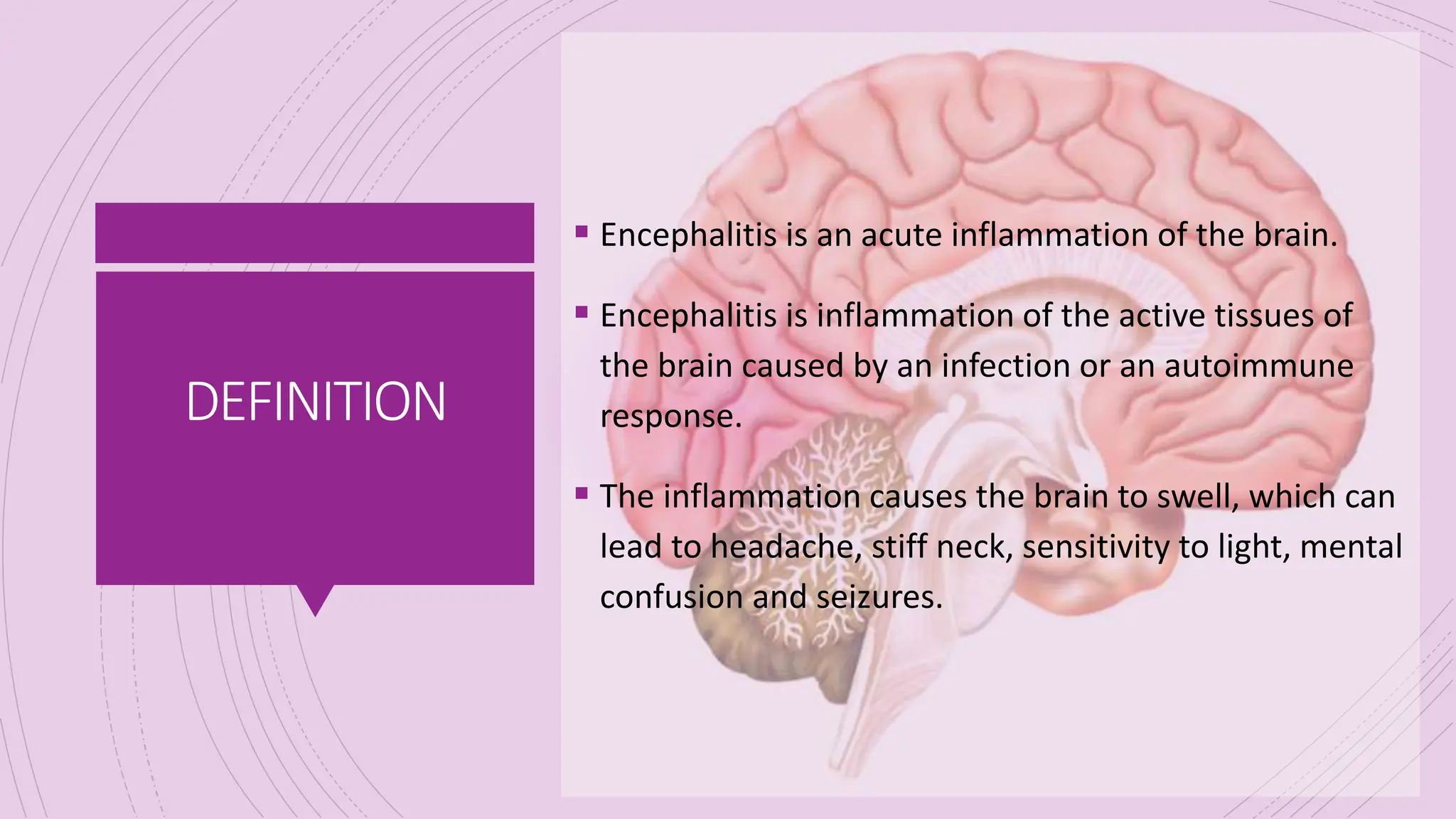 INFECTION OF THE BRAIN -ENCEPHALITIS ( PPT) | PPTX