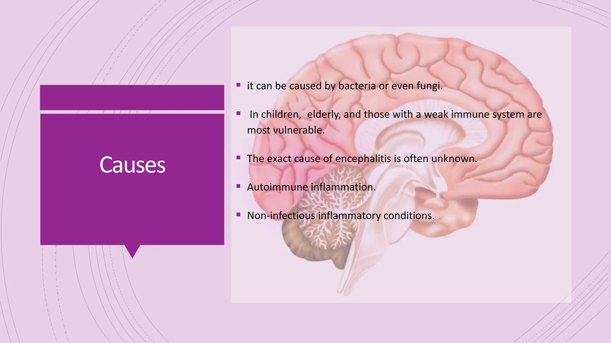 INFECTION OF THE BRAIN -ENCEPHALITIS ( PPT) | PPTX