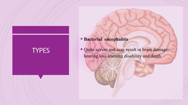 INFECTION OF THE BRAIN -ENCEPHALITIS ( PPT) | PPTX