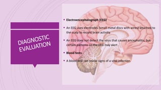 INFECTION OF THE BRAIN -ENCEPHALITIS ( PPT) | PPTX