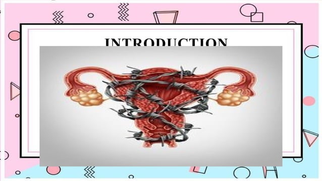 PPT ON ENDOMETRIOSIS- FEMALE REPRODUCTIVE HEALTH | PPTX