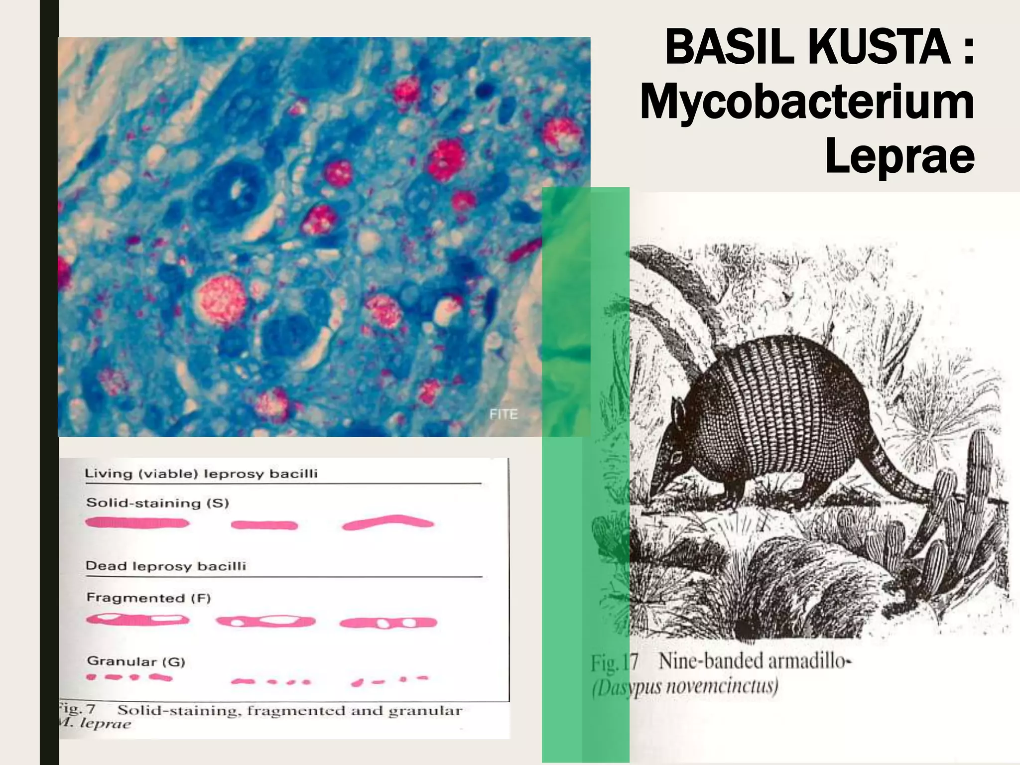 Ppt epidemiologi kusta | PPT
