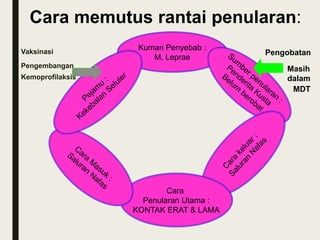 Ppt epidemiologi kusta | PPT