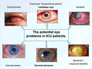 Ppt eye care. | PDF