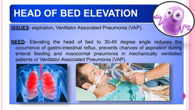 FAST HUGS BID | PPTX