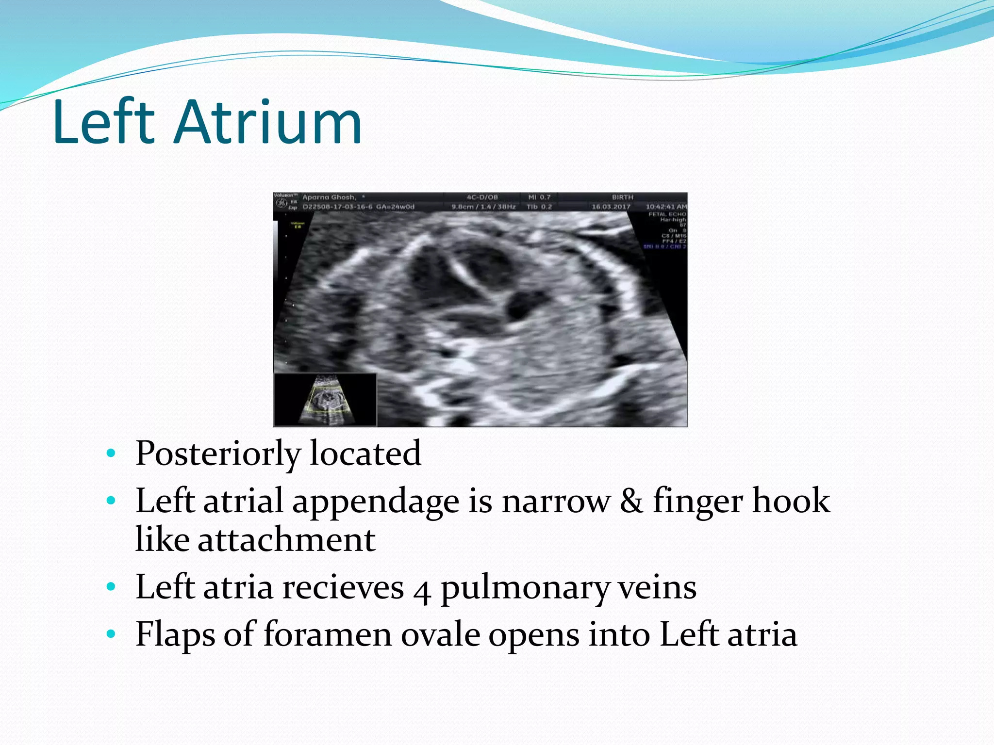 Ppt fetal echo | PPTX