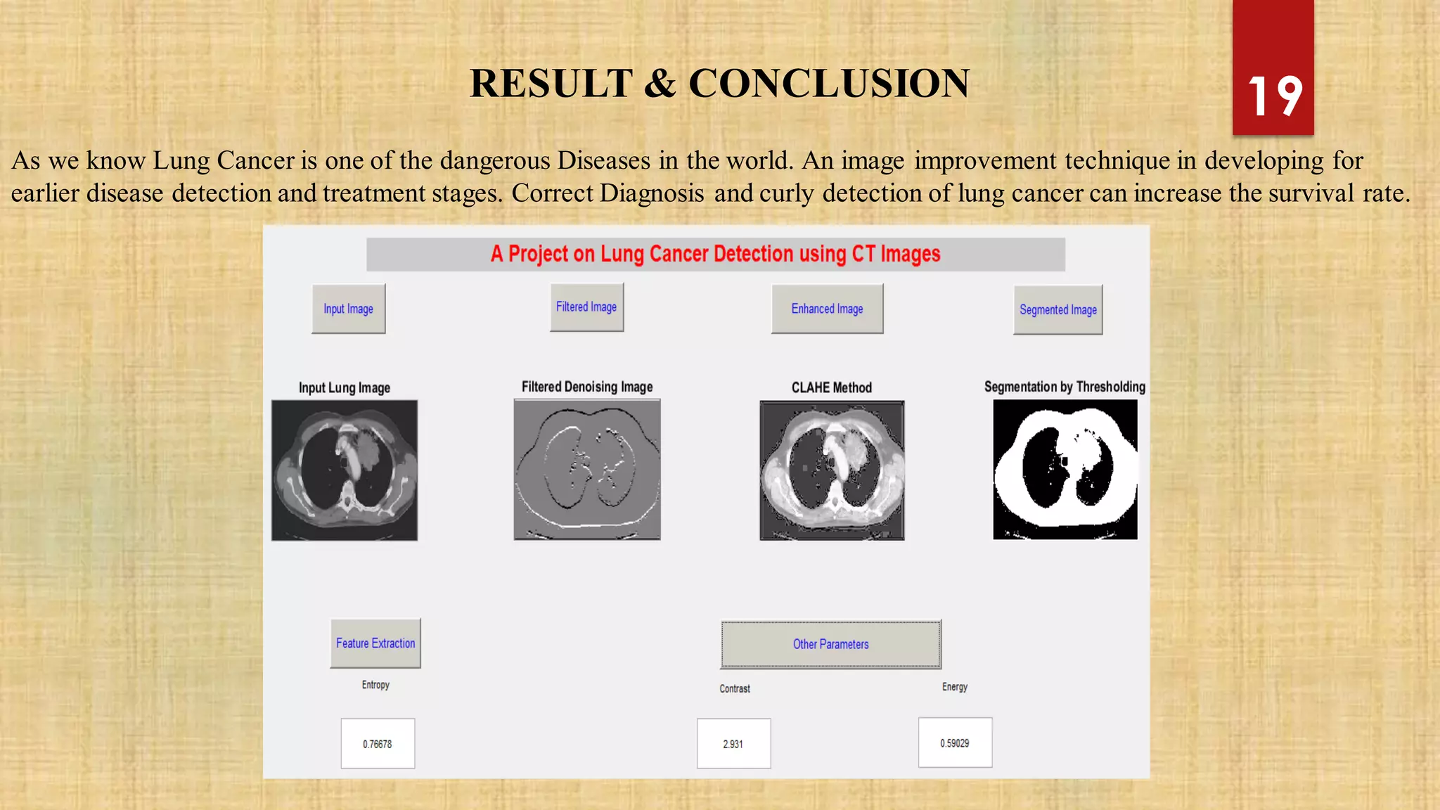Lung Tumour Detection using Image Processing | PDF
