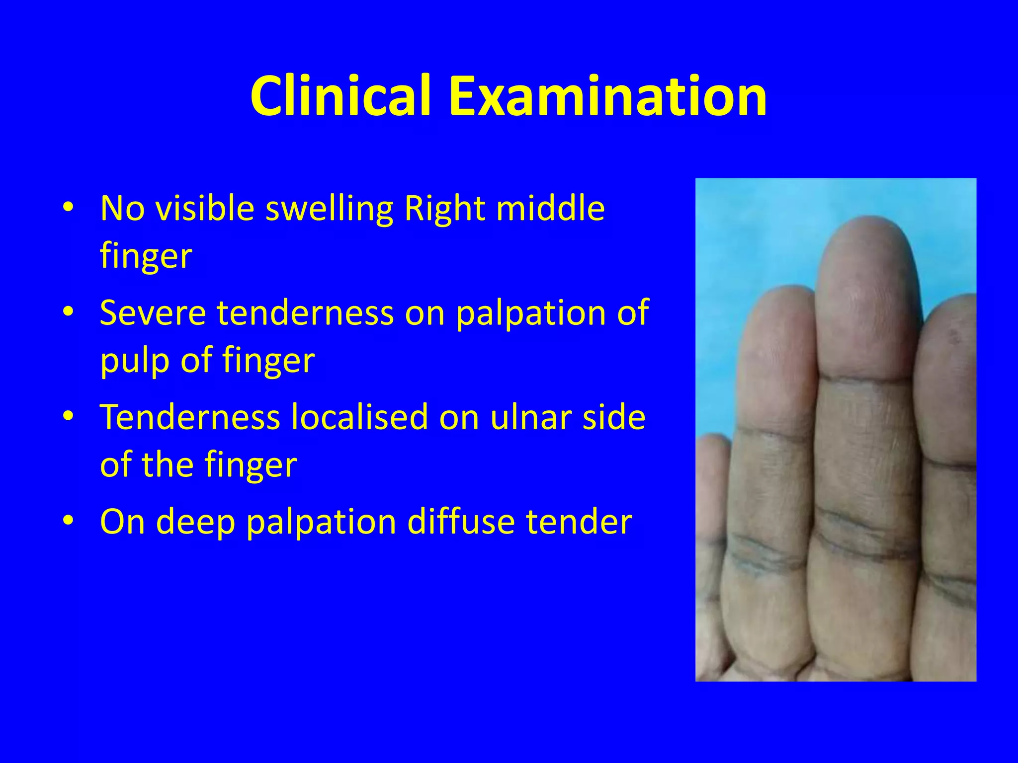 Ppt Glomus tumor of pulp of right middle finger | PPTX