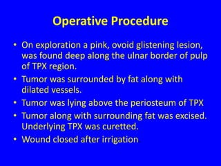 Ppt Glomus tumor of pulp of right middle finger | PPTX