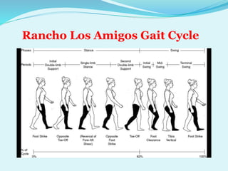 Rancho Gait Pattern