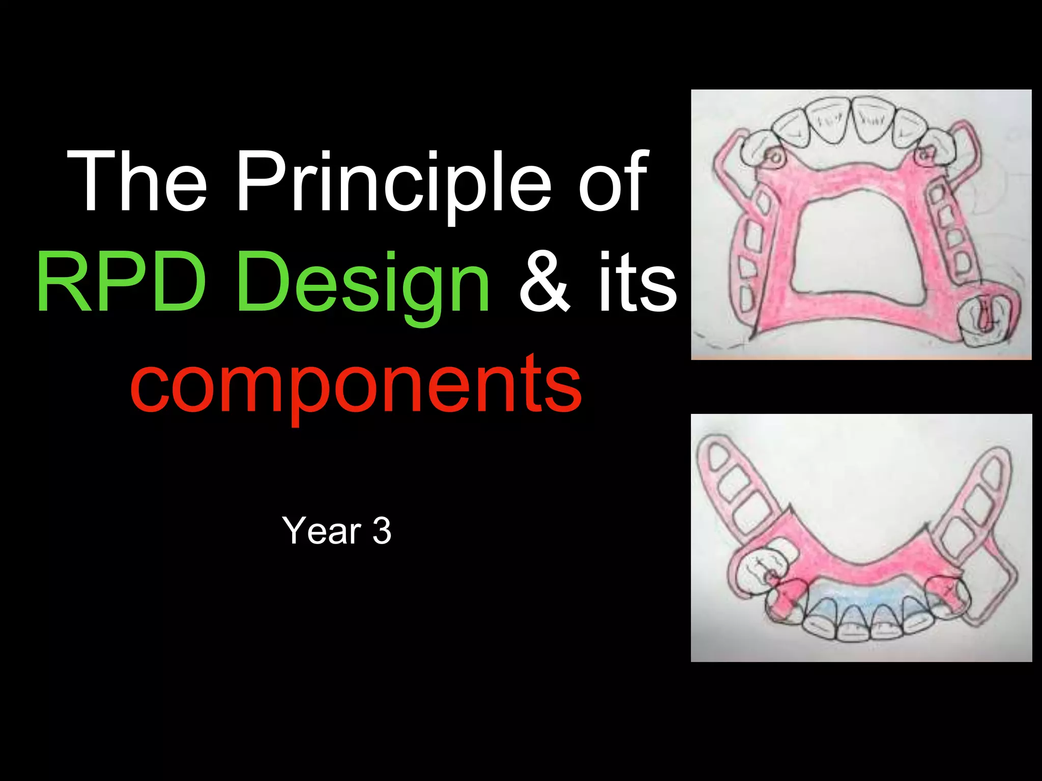 PPT (FINAL)The principles of RPD design & its components (Year 3) .pptx