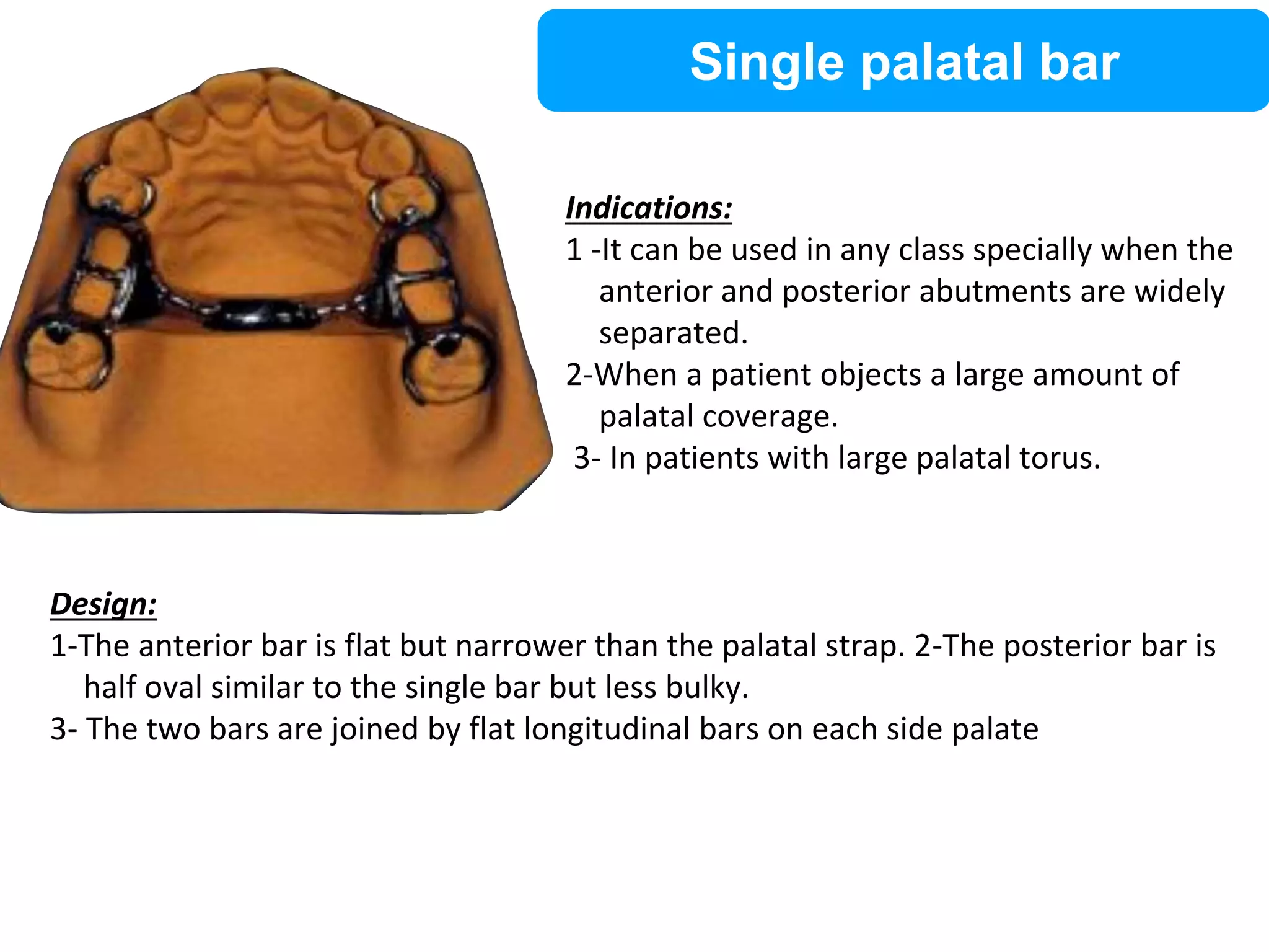 PPT (FINAL)The principles of RPD design & its components (Year 3) .pptx