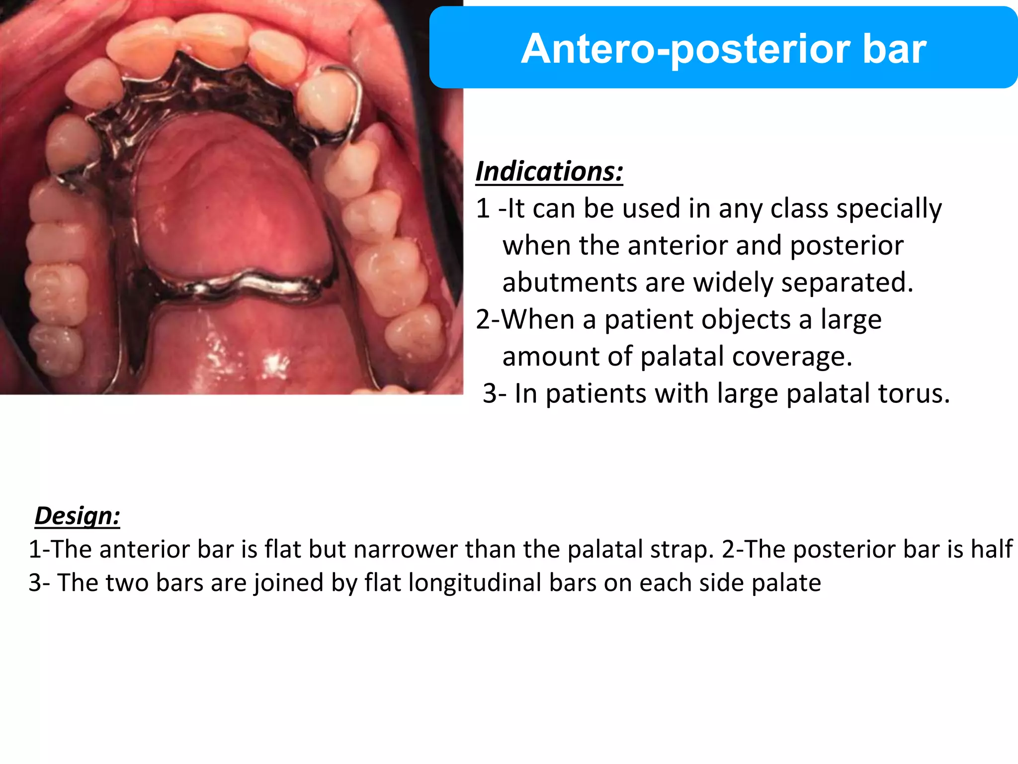 PPT (FINAL)The principles of RPD design & its components (Year 3) .pptx