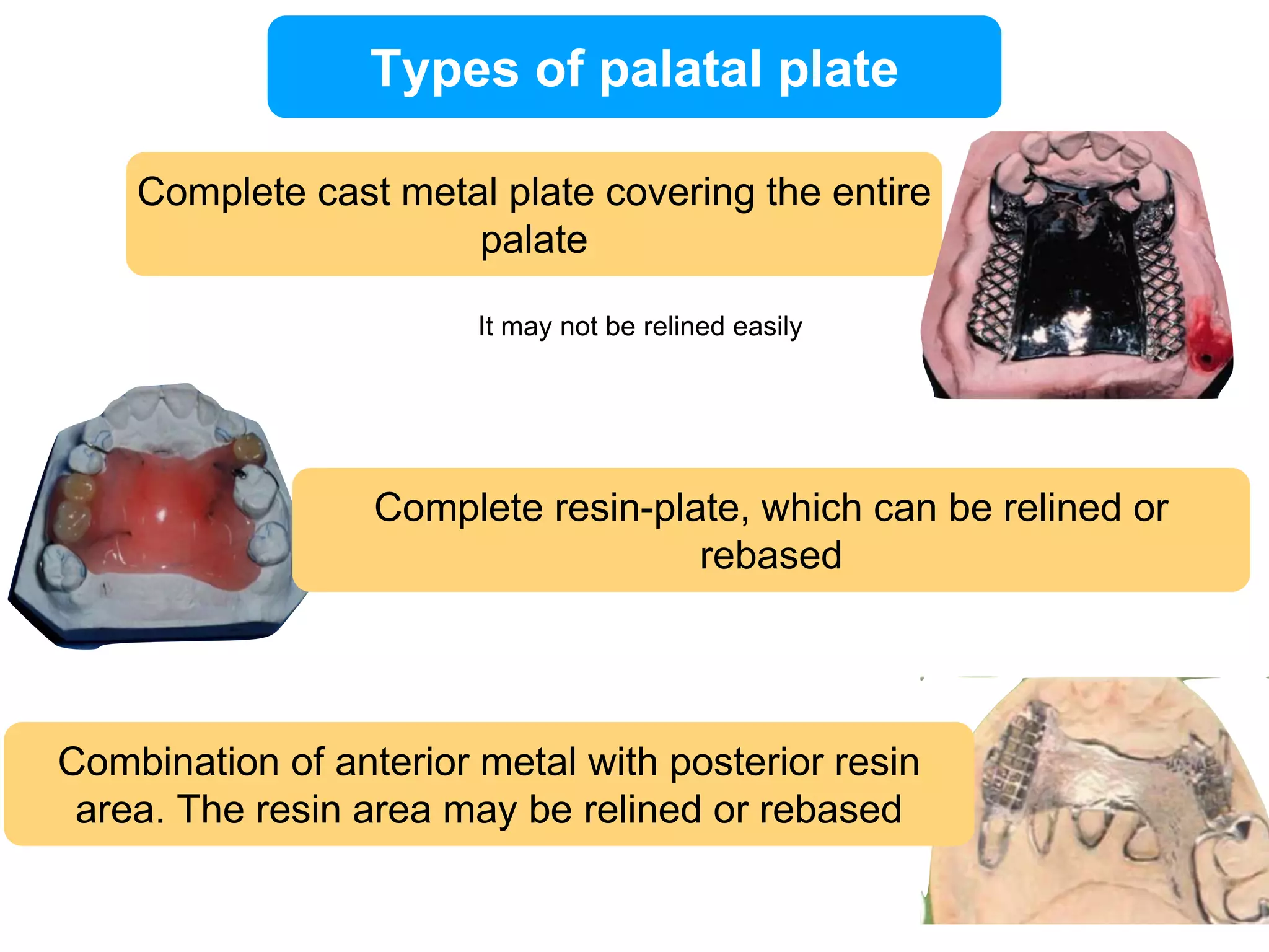 PPT (FINAL)The principles of RPD design & its components (Year 3) .pptx