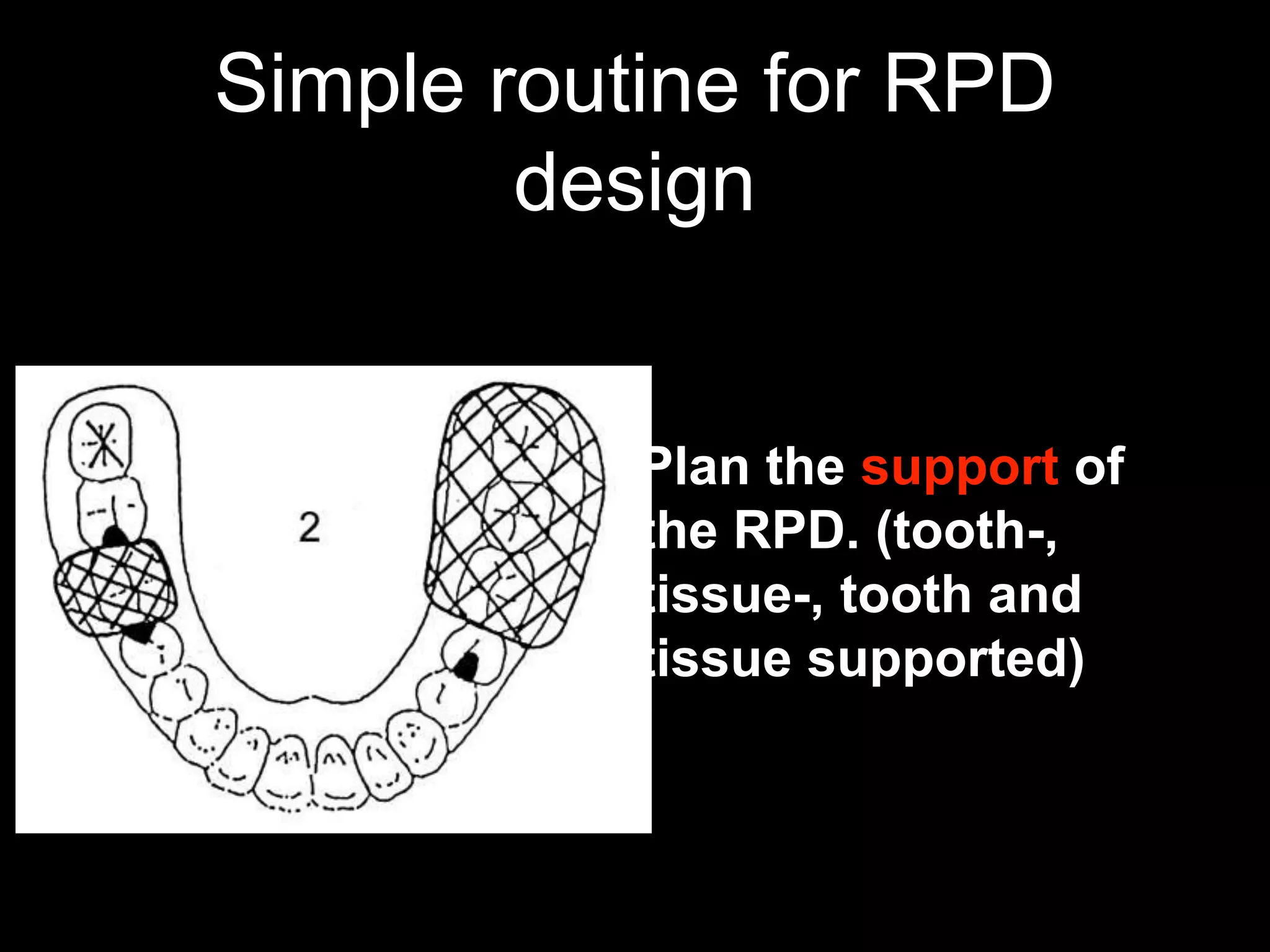 PPT (FINAL)The principles of RPD design & its components (Year 3) .pptx