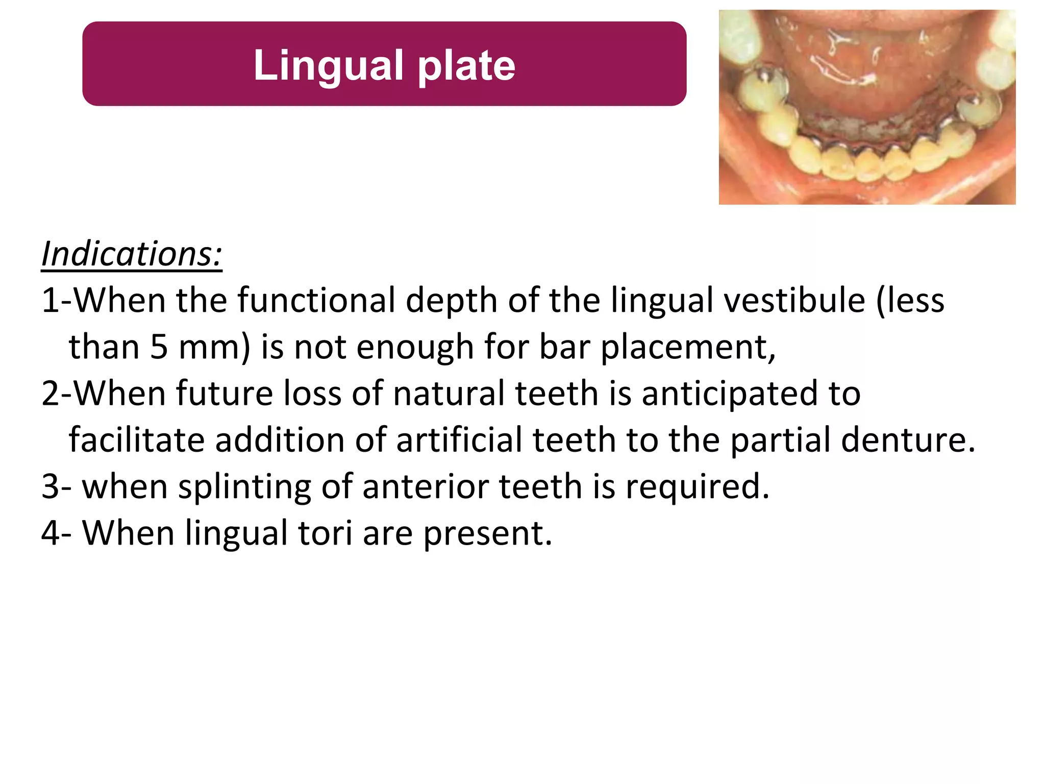 PPT (FINAL)The principles of RPD design & its components (Year 3) .pptx