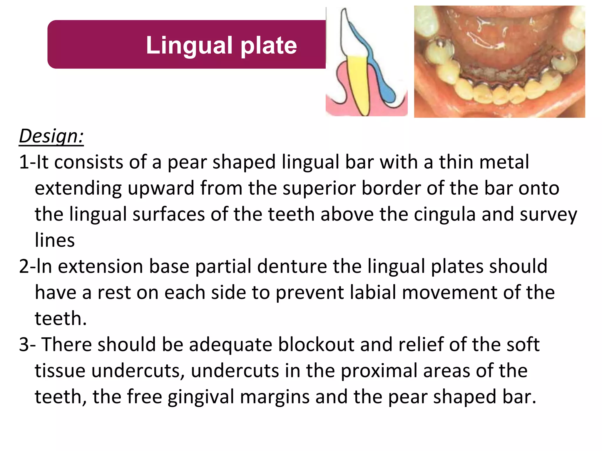 PPT (FINAL)The principles of RPD design & its components (Year 3) .pptx