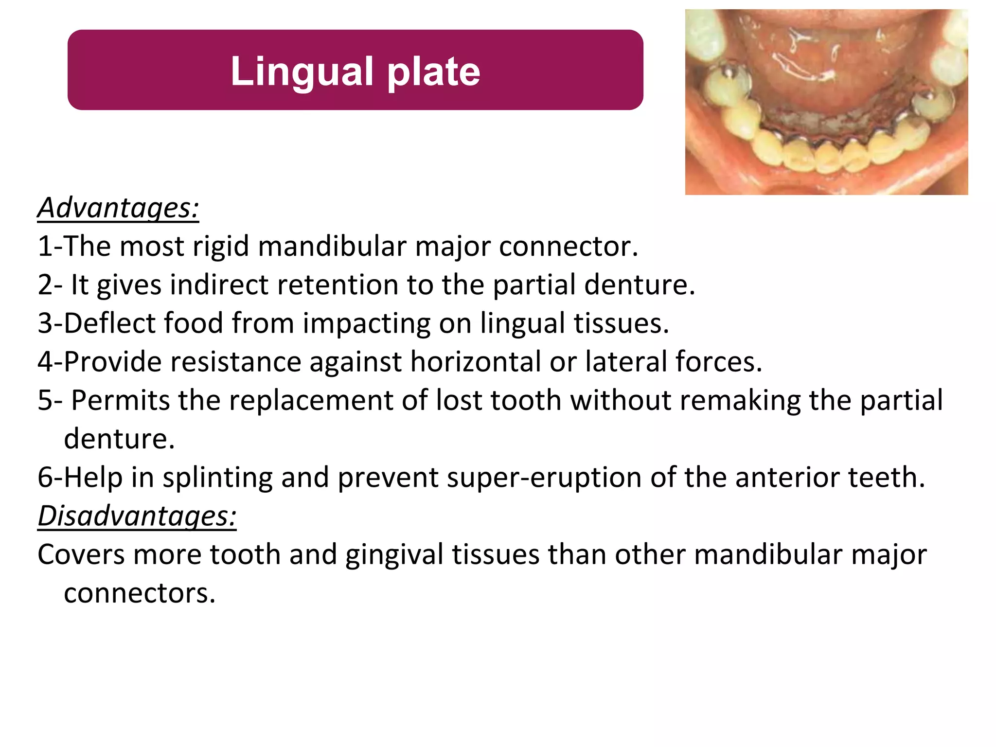PPT (FINAL)The principles of RPD design & its components (Year 3) .pptx