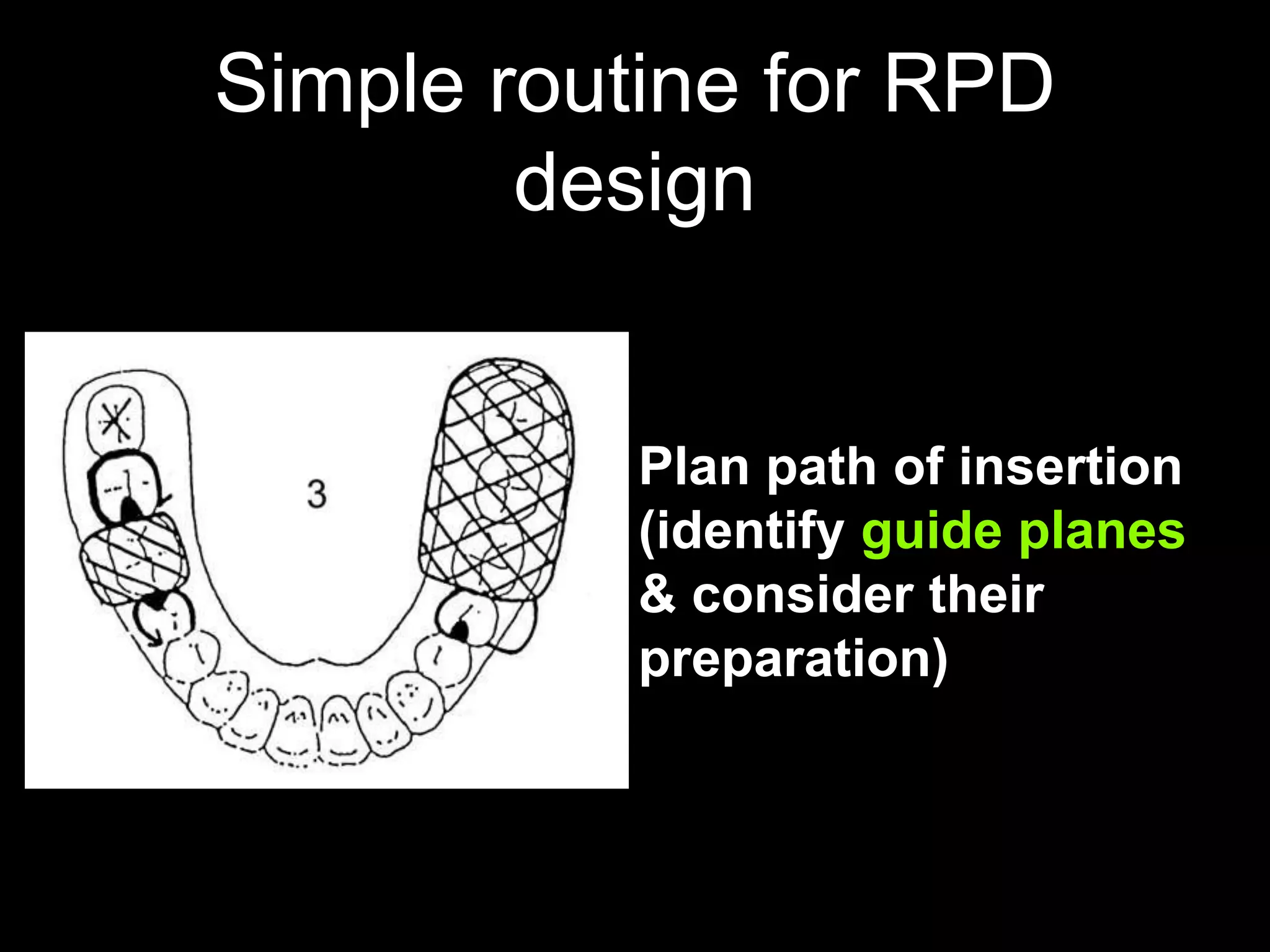 PPT (FINAL)The principles of RPD design & its components (Year 3) .pptx