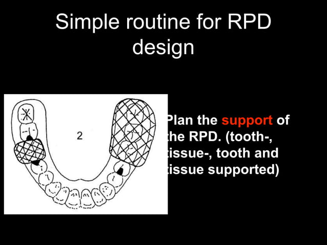 PPT (FINAL)The principles of RPD design & its components (Year 3) .pptx ...