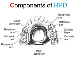 PPT (FINAL)The principles of RPD design & its components (Year 3) .pptx