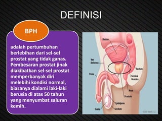 PPT_FIX_BPH.pptx