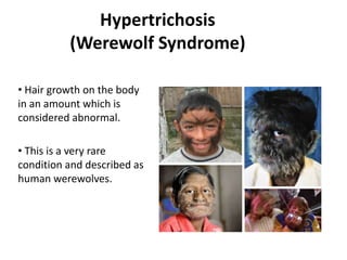 10 Weirdest Medical Conditions | PPTX