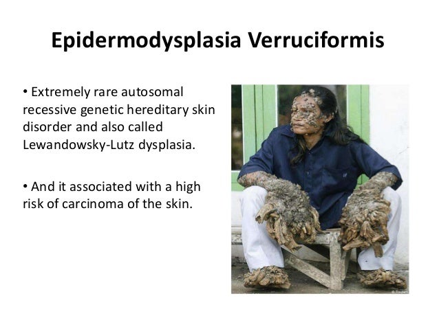 10 Weirdest Medical Conditions