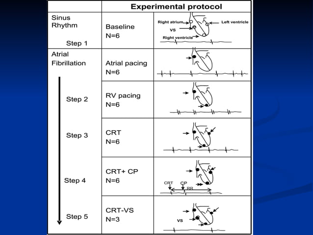 Cardiac Pacing MS PPT | PPT