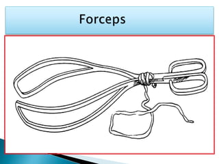 forceps delivery | PPTX