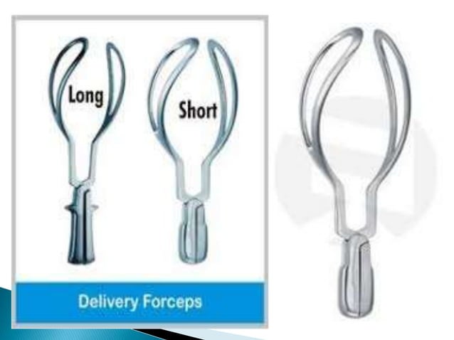 forceps delivery | PPTX | Pregnancy | Reproductive Health
