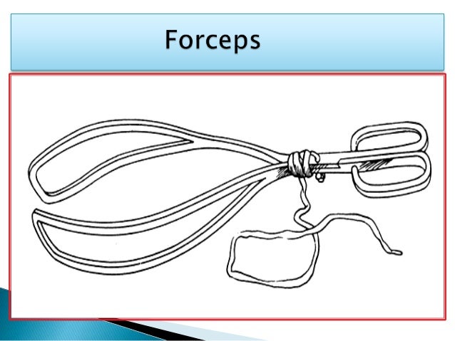 forceps delivery