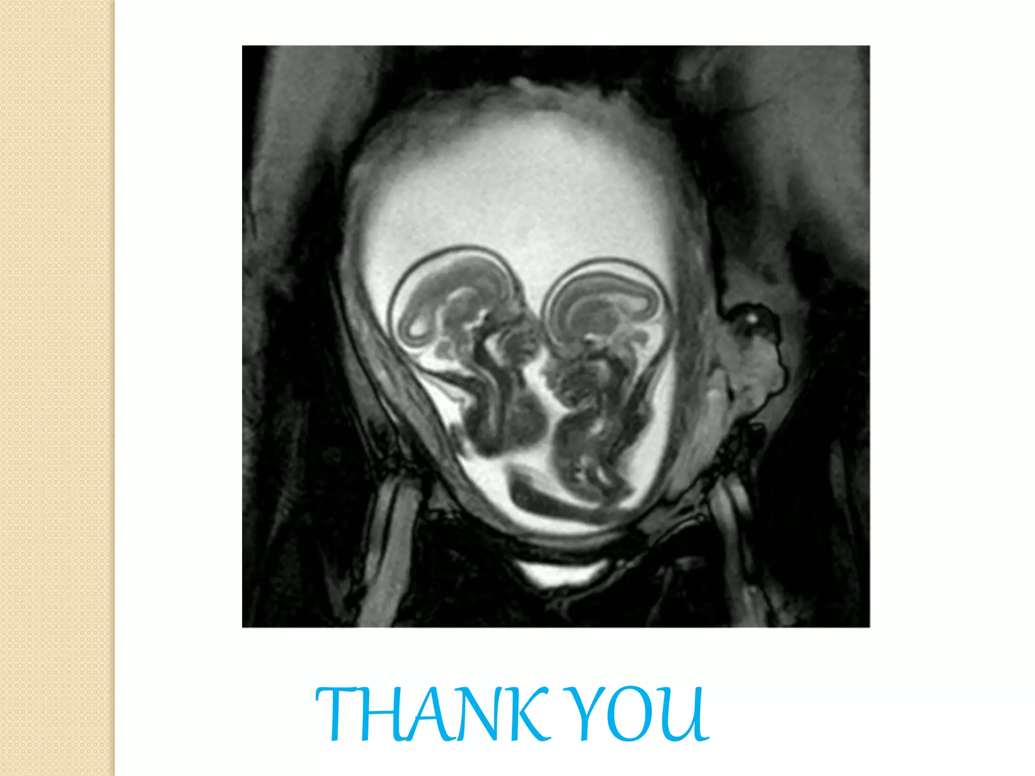 mri vs usg for fetal cns anoalies | PPTX