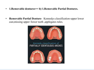 Ppt for spotters | PPTX