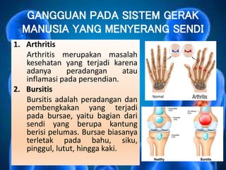 PPT GANGGUAN SISTEM GERAK PADA MANUSIA QESYA.pptx