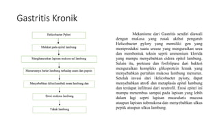 preskripsi gastritis | PPT
