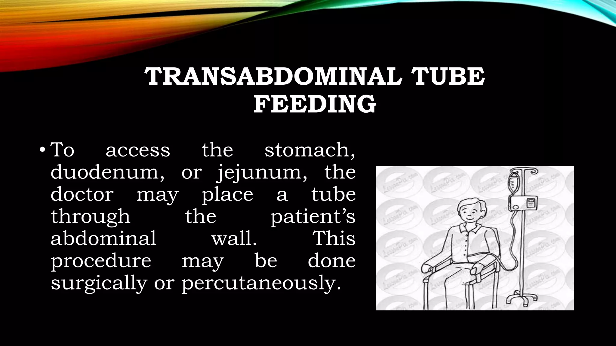 presentation on gastrostomy and jejunostomy feeding | PPTX