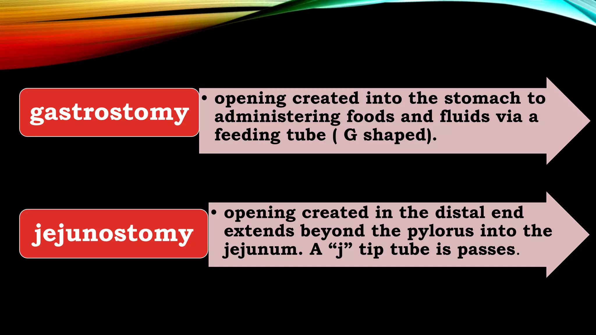 presentation on gastrostomy and jejunostomy feeding | PPTX