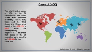 Hepatocellular Carcinoma (HCC) | PPTX