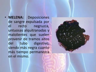 Melena Heces