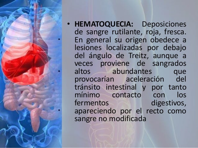 HEMORRAGIA INTESTINAL BAJA EN PEDIATRIA